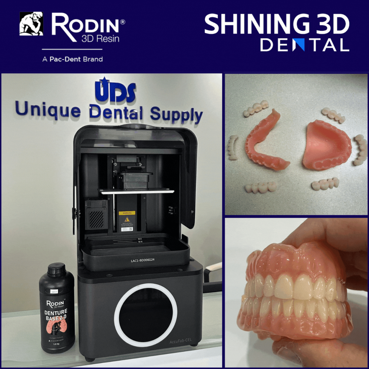 Denture printing using Rodin® Resins and Shining 3D® CEL Printer ...