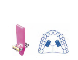 Medium Screw – Unique Dental Supply Inc.